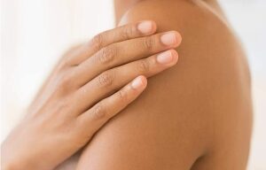 Blackheads Around Lips: Causes, Treatments, and Prevention