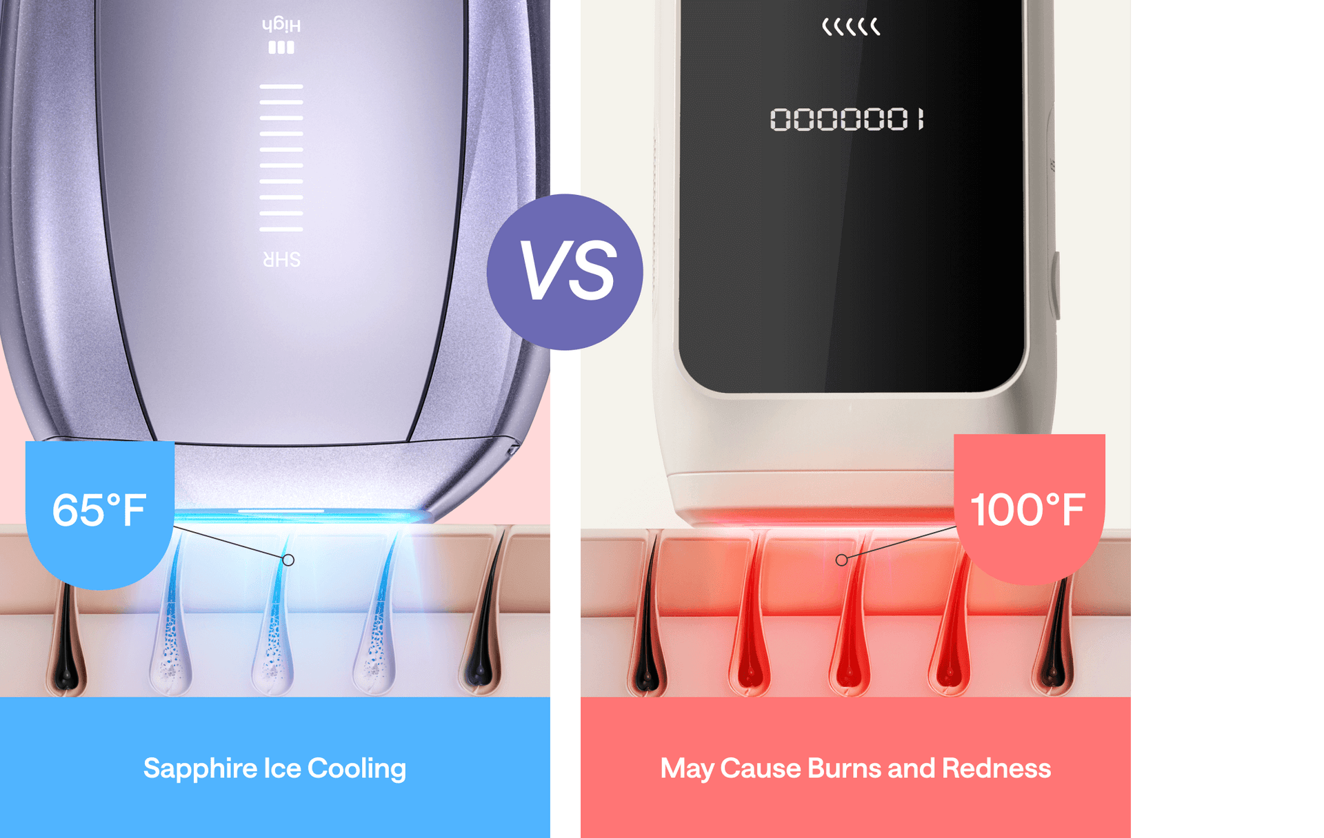 Ulike Air 10: 96% Hair Reduction in 2 Weeks,90-Day 100% Guarantee