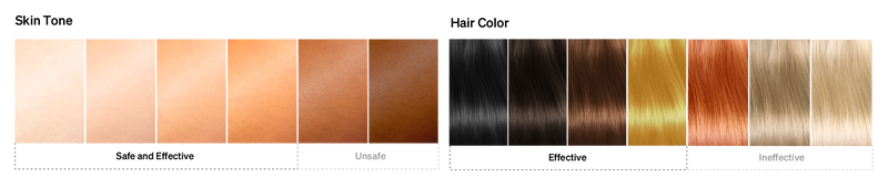PCOS Hair Removal - Ulike