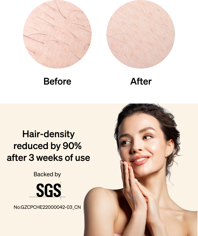 Ulike Prime Deal Days: $70 OFF and chance to win UV sterilizer