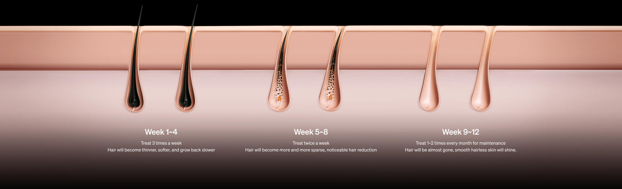 How Does Ulike IPL Hair Removal Work?